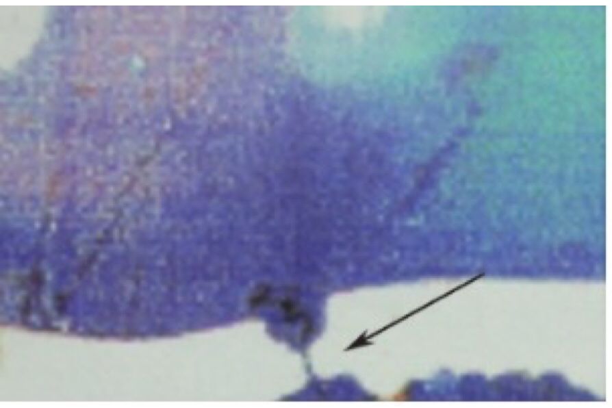 PCBA组装中PCB的断路缺陷的几种原因分析 – 可靠性网